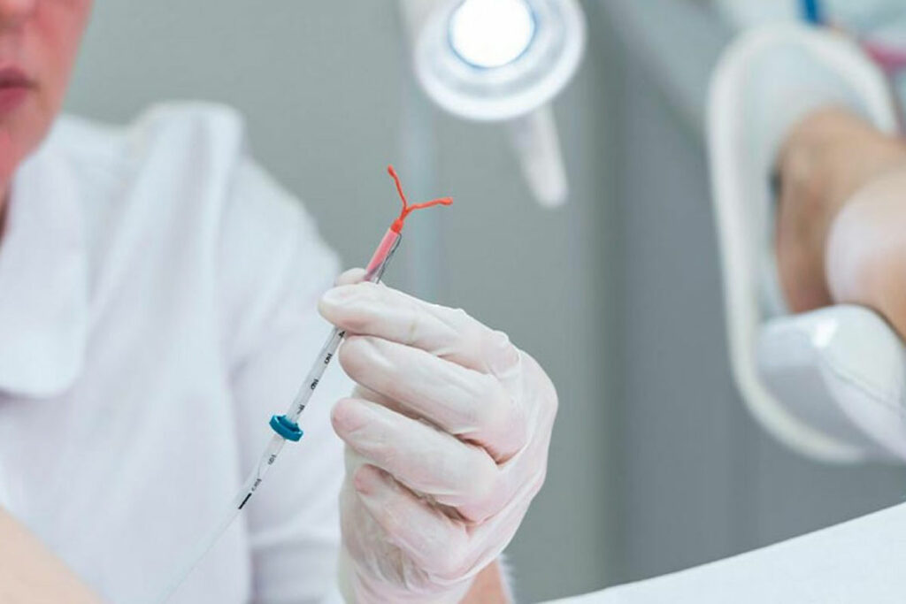 Enfermeiras e enfermeiros podem inserir e retirar DIU | Conselho ...